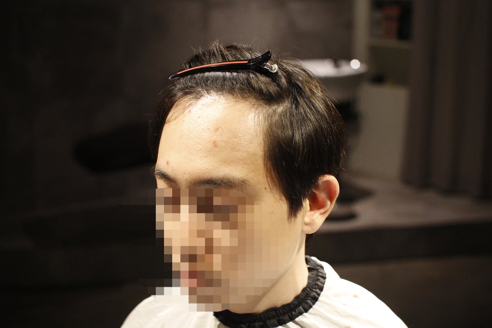 이마 넓은 남자 머리로 어울리는 스왈로펌 네이버 블로그