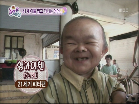 하이랜더 증후군(Highlander Syndrome) : 네이버 블로그