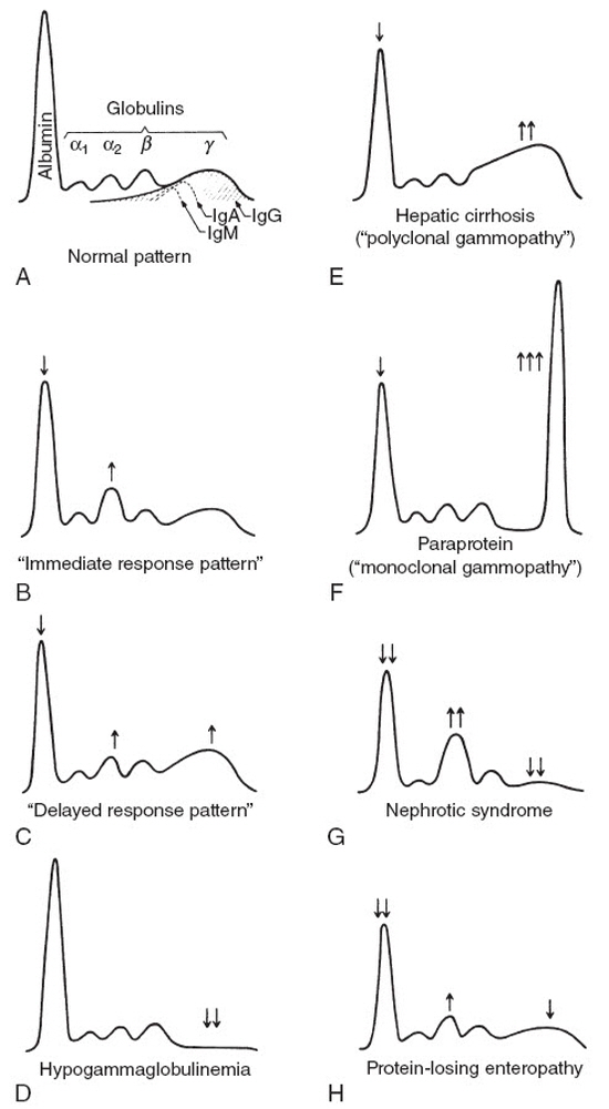 단백전기영동(Protein Electrophoresis) : 네이버 블로그